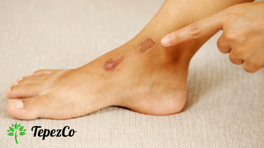 Wundheilung ohne Narbenbildung. | Blog | TepezCo DE